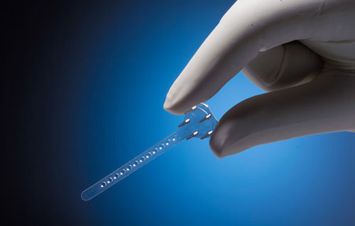 Endoscopic Endotine Forehead / Midface Lift – 知美整形外科診所